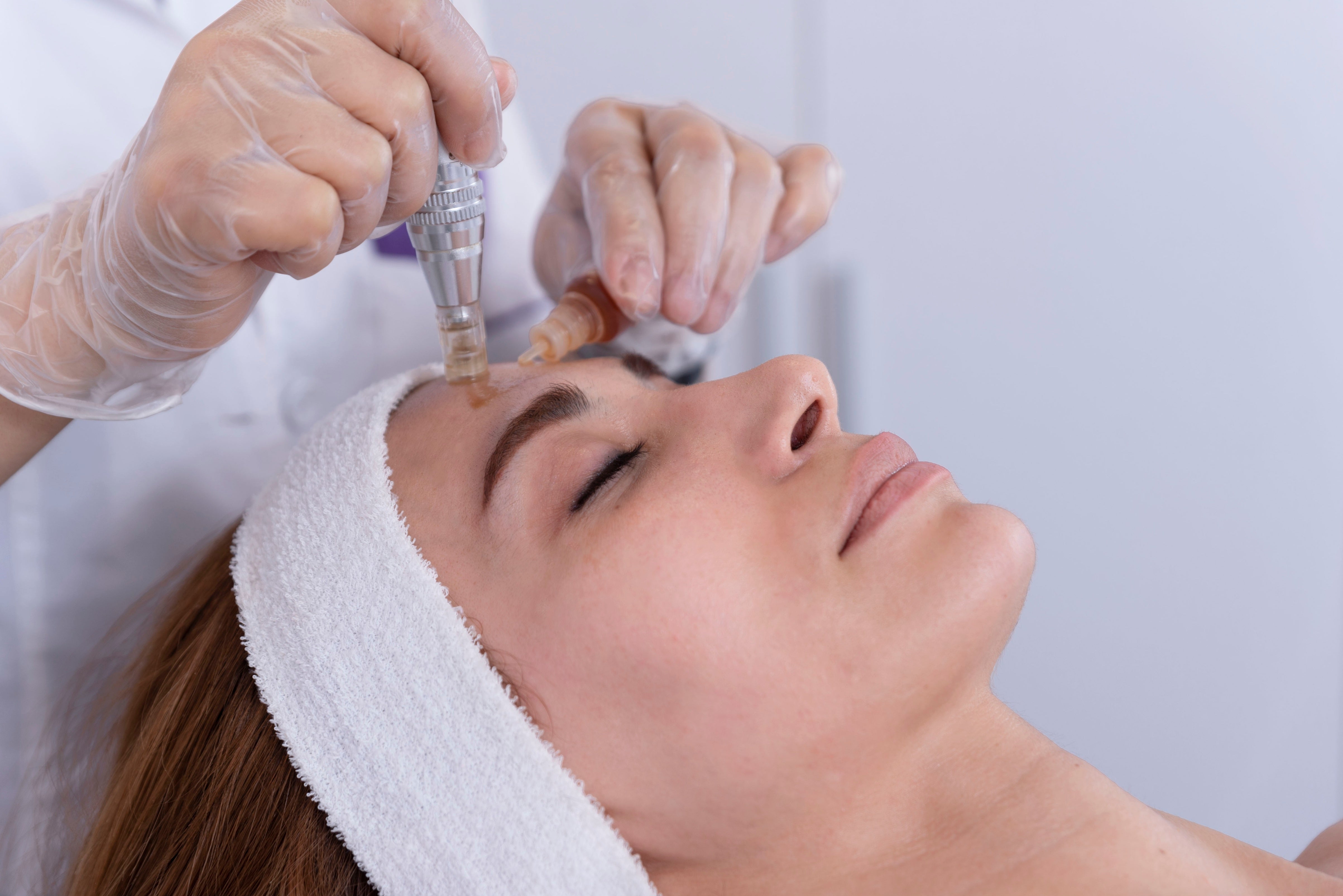 Microneedling Face – AESTHETIC CARE BEAUTY CLINIC
